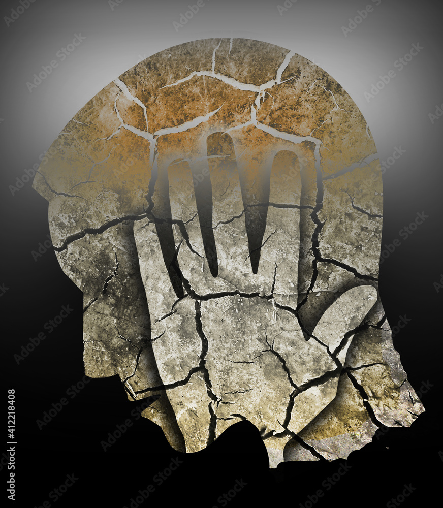 Depression Headache, male head. The man held his head with cracked ...