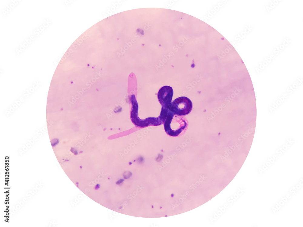 Microfilariae are sheathed in the blood smear of a dog. Light ...