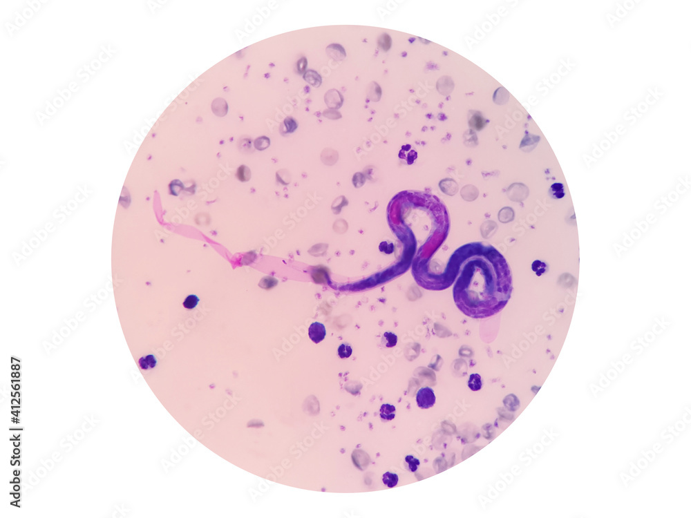 Foto de Microfilariae are sheathed in the blood smear of a dog. Light ...