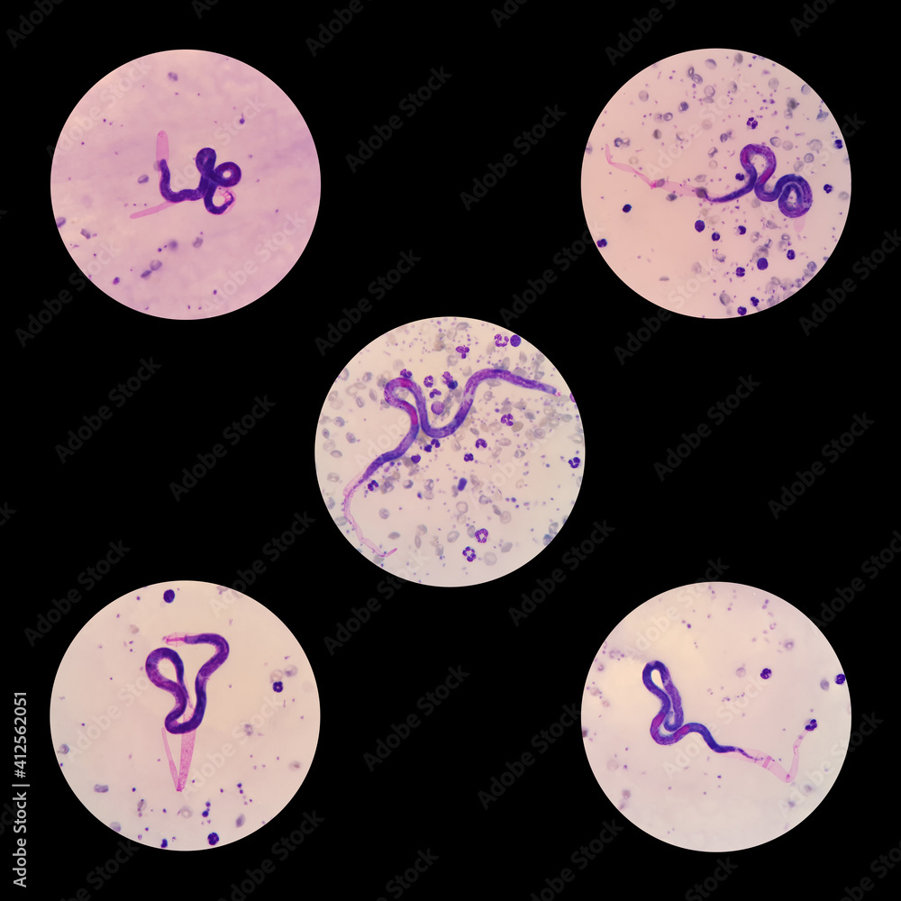 Foto de Microfilariae are sheathed in the blood smear of a dog. Light ...