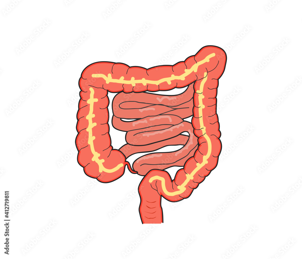 colon part of human body anatomy and disease Stock Vector | Adobe Stock