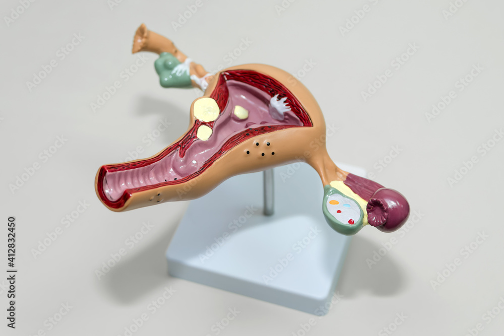 Plastic model of woman reproductive system. Anatomical model of uterus ...