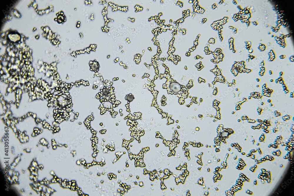 Mold spores under the light microscope, orange peel mold, magnification ...
