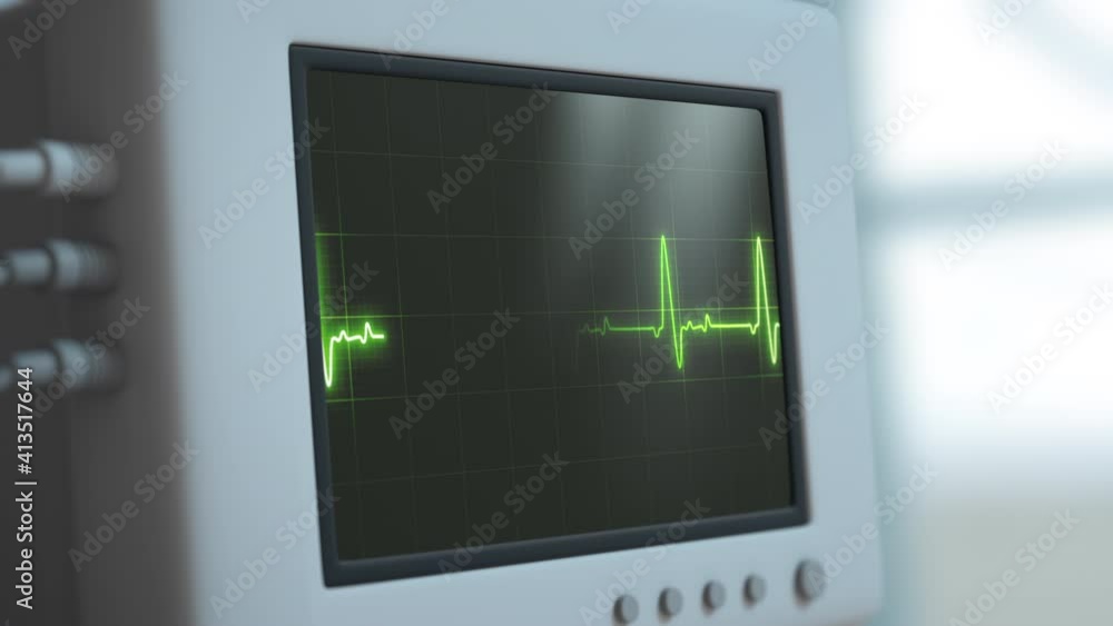 Heart rate, heart beat line displayed on hospital monitor. Cardiogram ...