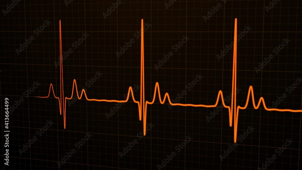 Loopable: Orange 3D EKG/ECG cardiogram oscilloscope monitor heartbeat ...