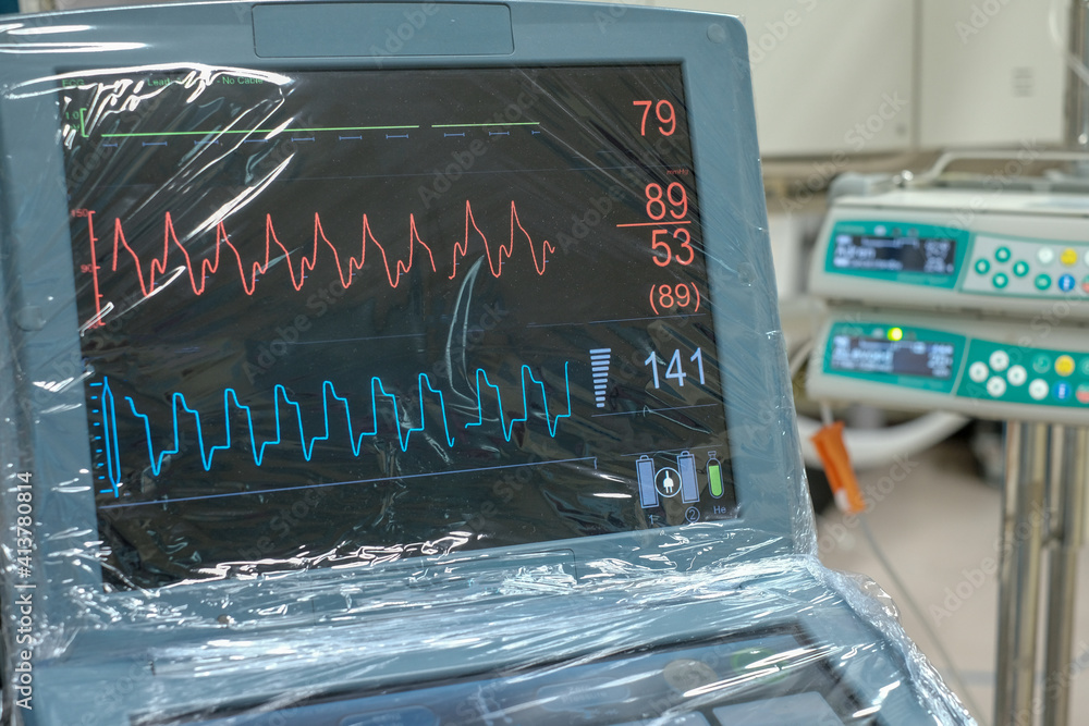 EKG monitor in intra aortic balloon pump machine. Medical equipment ...
