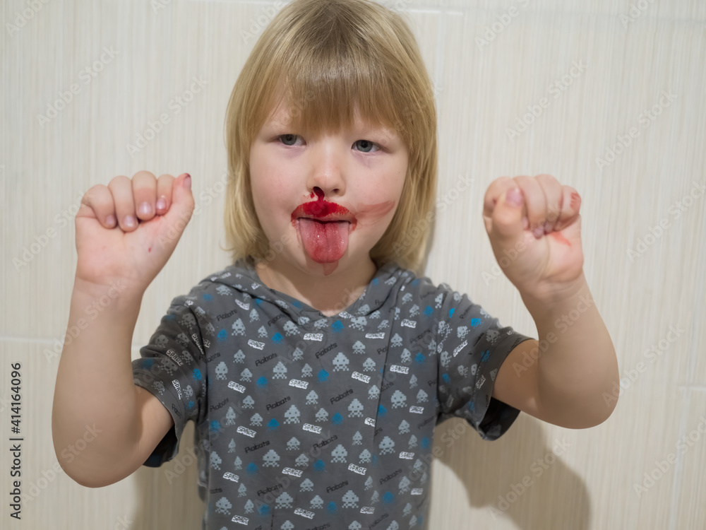 little fair-haired boy is smeared with blood. baby has weak vessels in ...