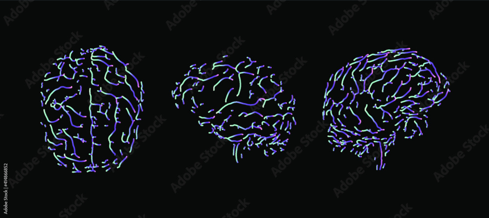 The human brain from the front and side view. MRI of CT scan. Stock ...