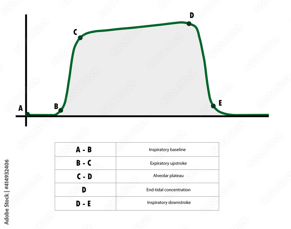 Capnography Waveform Phases. Description of each phase from capnography ...
