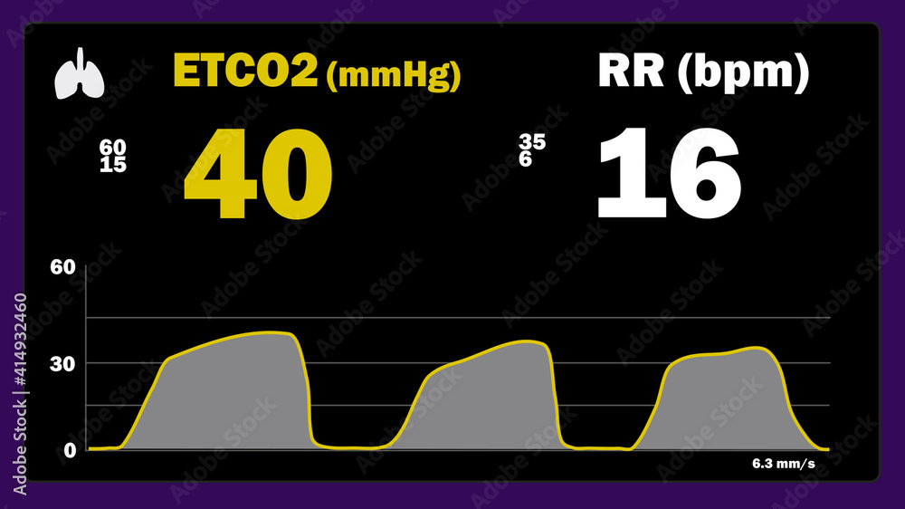 Capnography Monitor Equipment Screen - ETCO2 and RR Stock Illustration ...