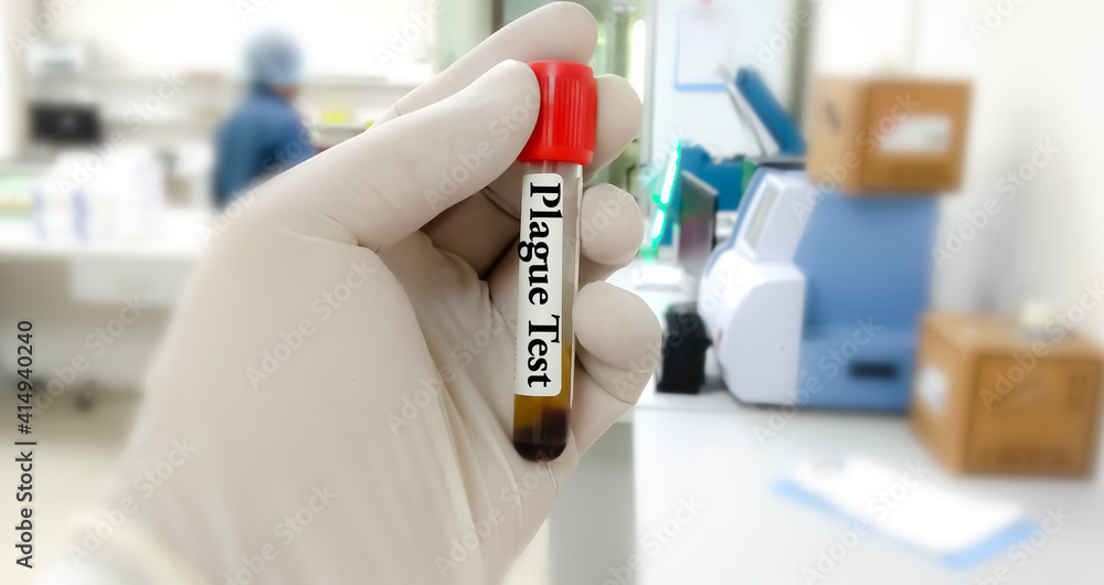 Blood sample for Plague test, infectious disease caused by the bacteria ...
