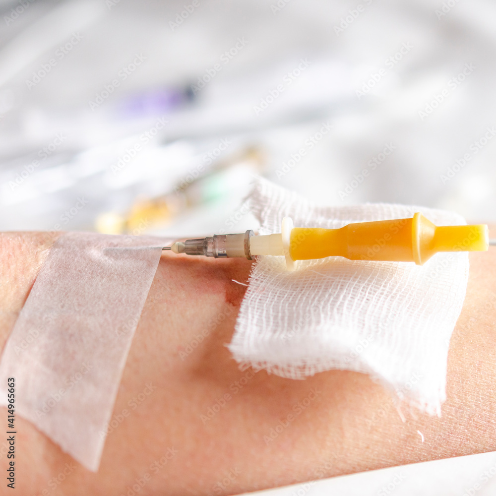 Medicine. Intravenous injection. The drip is intravenous. First aid ...