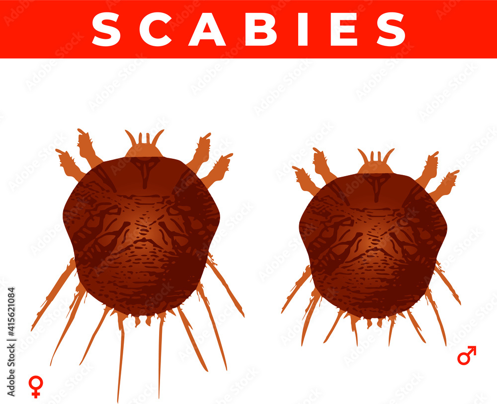 Scabies. Scabies Vector. Scabies Isolated Art Stock Vector | Adobe Stock