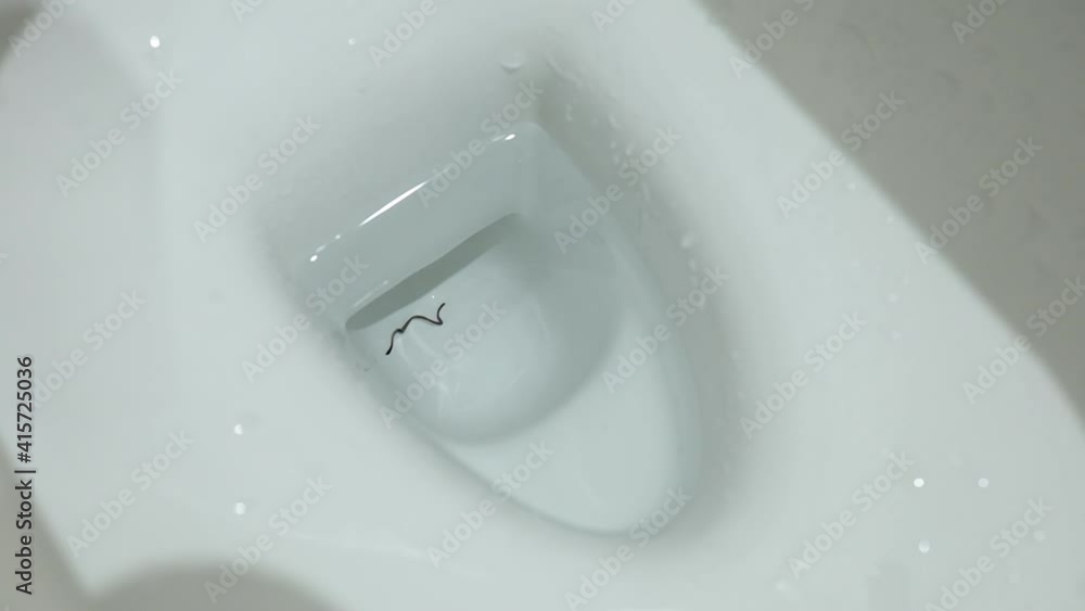 Enterobius vermicularis parasite filling in toilet vídeo de Stock ...