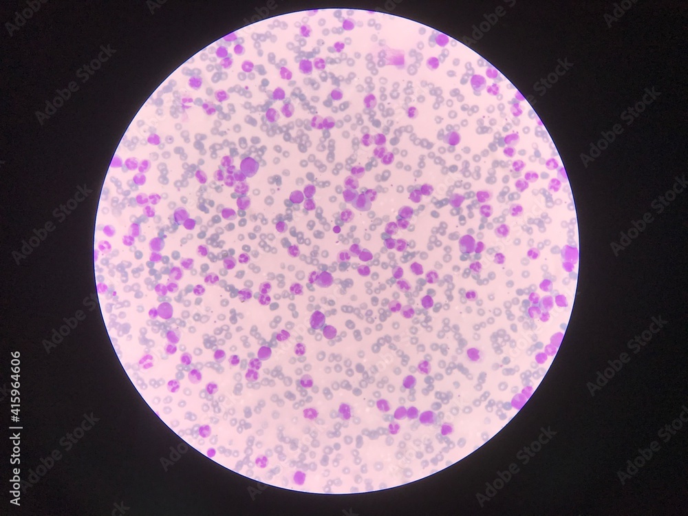 Immature and mature white blood cells.Segmented neutrophil,blast cells ...