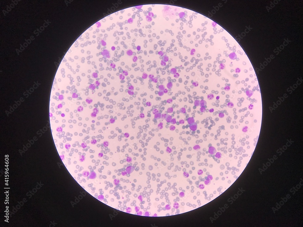 Immature and mature white blood cells.Segmented neutrophil,blast cells ...