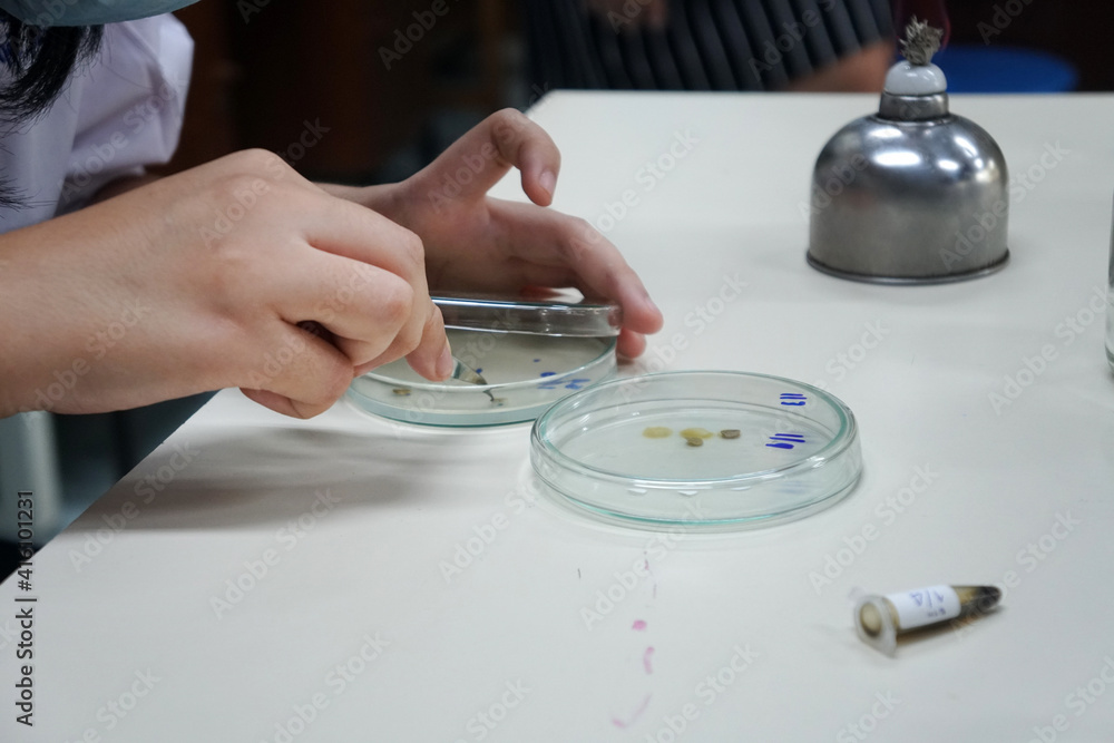 The hand was holding the filter paper tongs onto the prepared petri ...