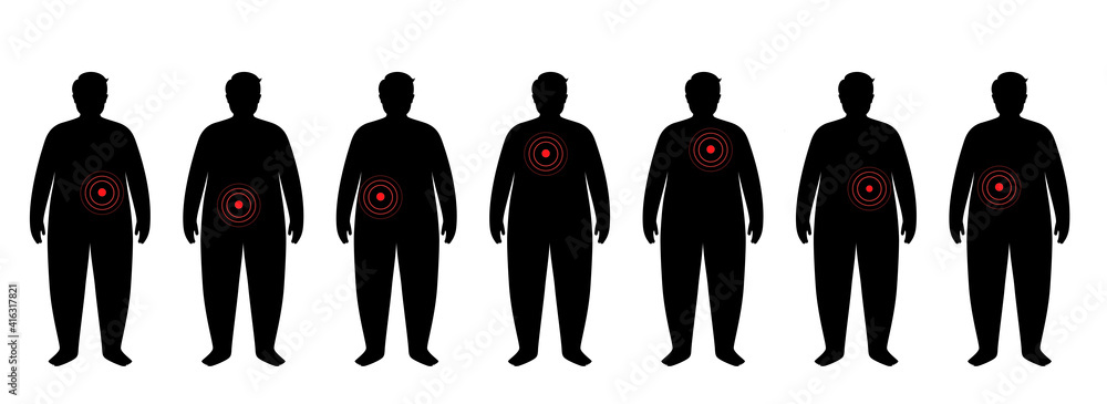Organs in obese human body Stock Vector | Adobe Stock