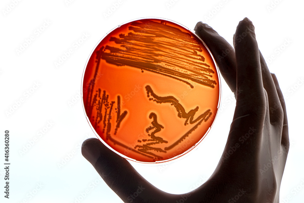 Laboratory technician tests for bacterial infection analyzes bacterial ...