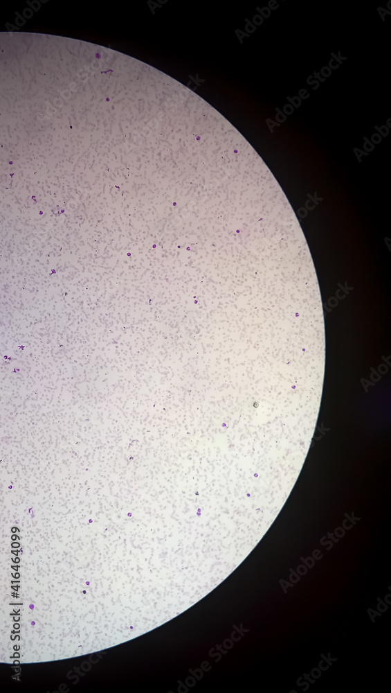 Microscopic view of hematology slide. RBC. WBC. closeup. Stained slide ...