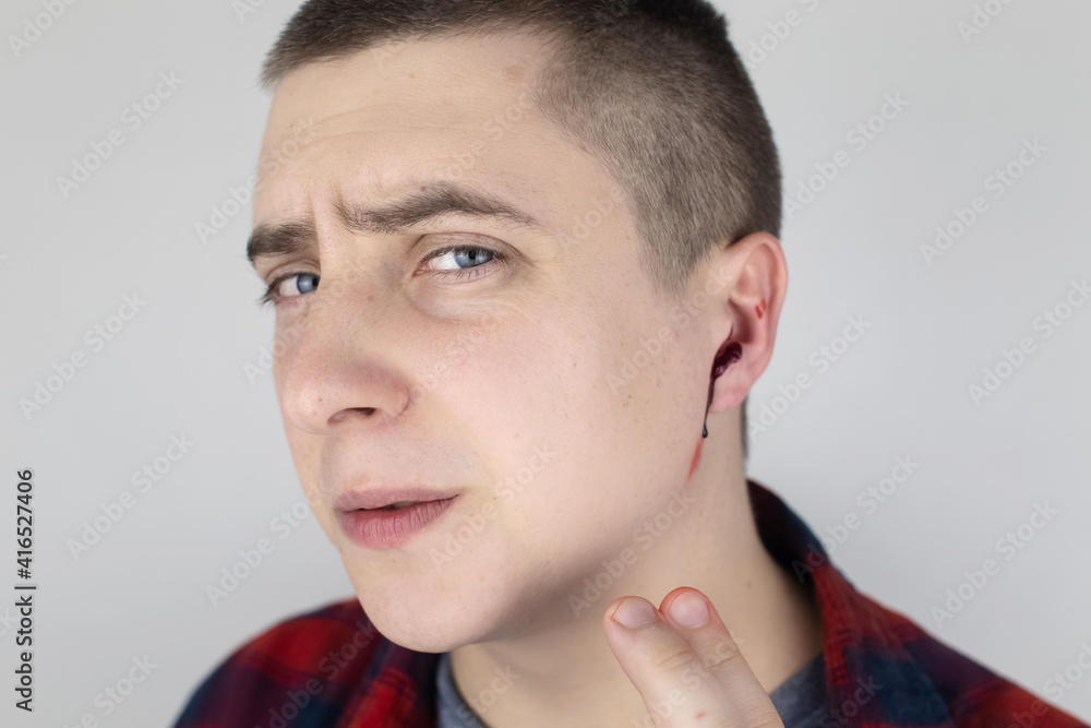 A man whose ear is bleeding. Vascular rupture, damage to the tympanic ...