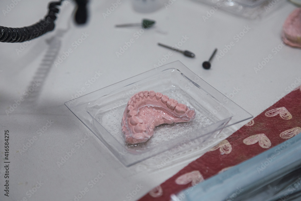 Dental casting gypsum model plaster cast stomatologic human jaws ...