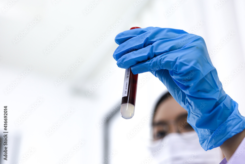Scientist holding Coronavirus covid-19 infected blood sample tube DNA ...