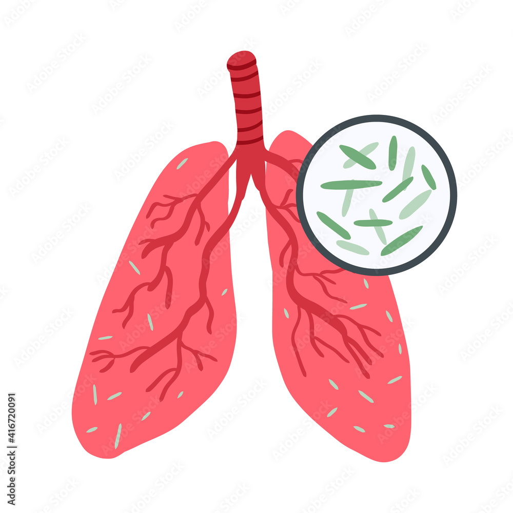 World tuberculosis day banner. Human lungs infected with tubercle ...