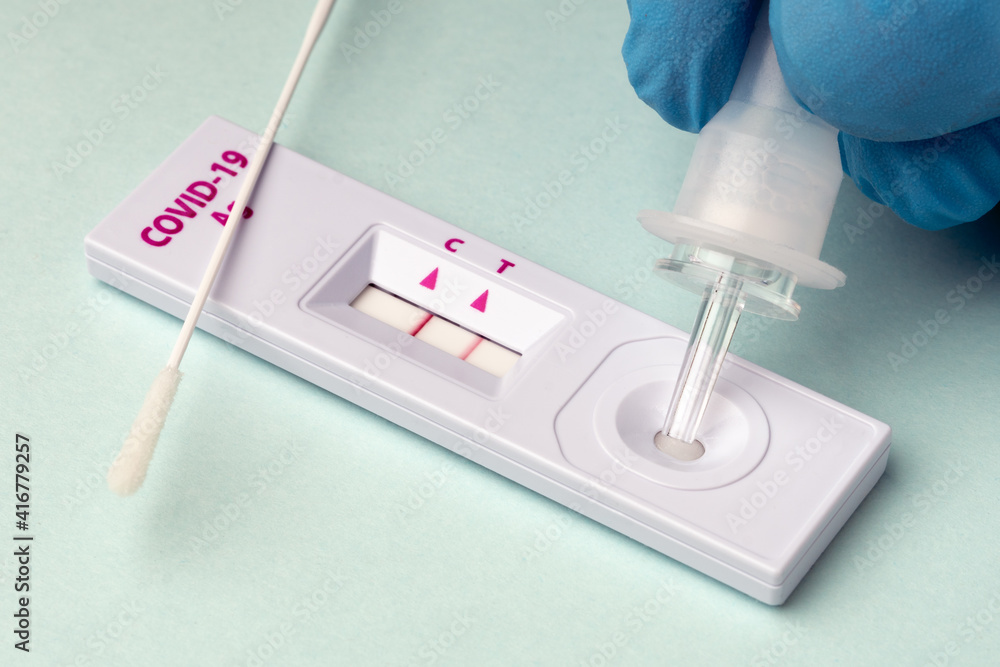 Doctor makes a covid-19 antigen pcr express test macro. The test showed ...