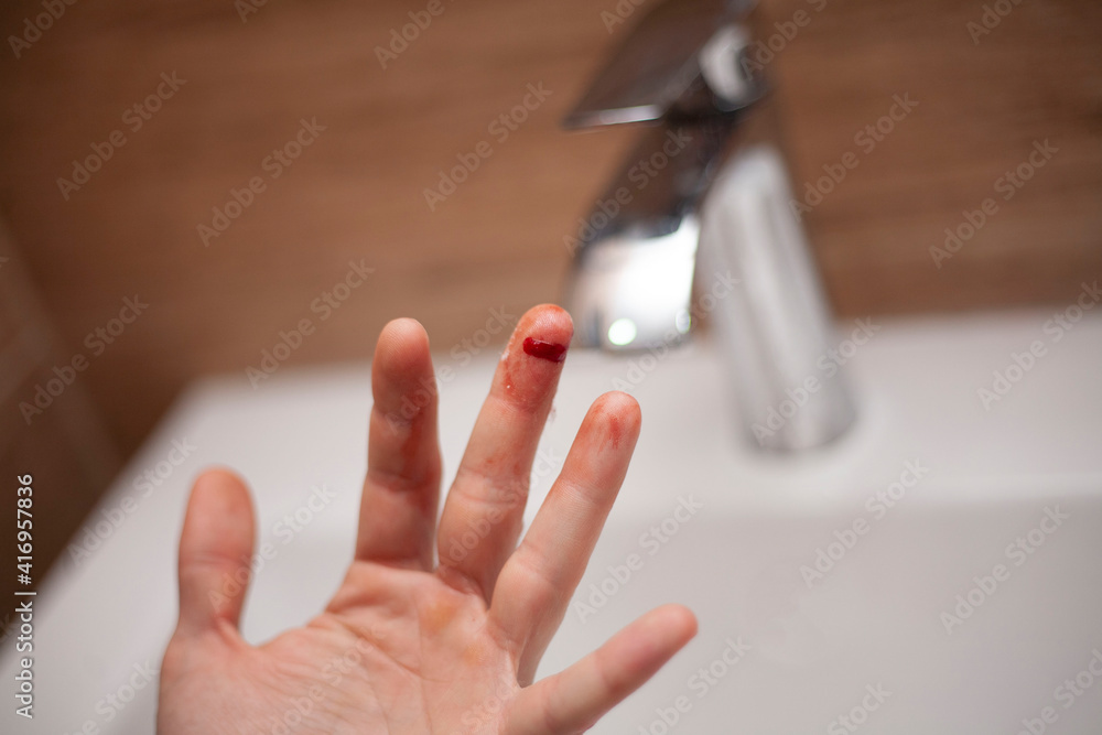 The man cut his finger. A cut. Blood flows from the finger Stock Photo ...