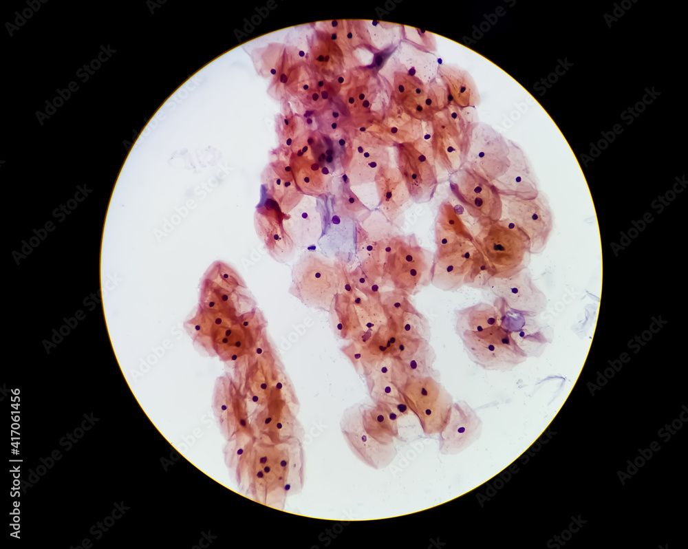 Normal endocervical cells and squamous epithelial cells of cervical ...