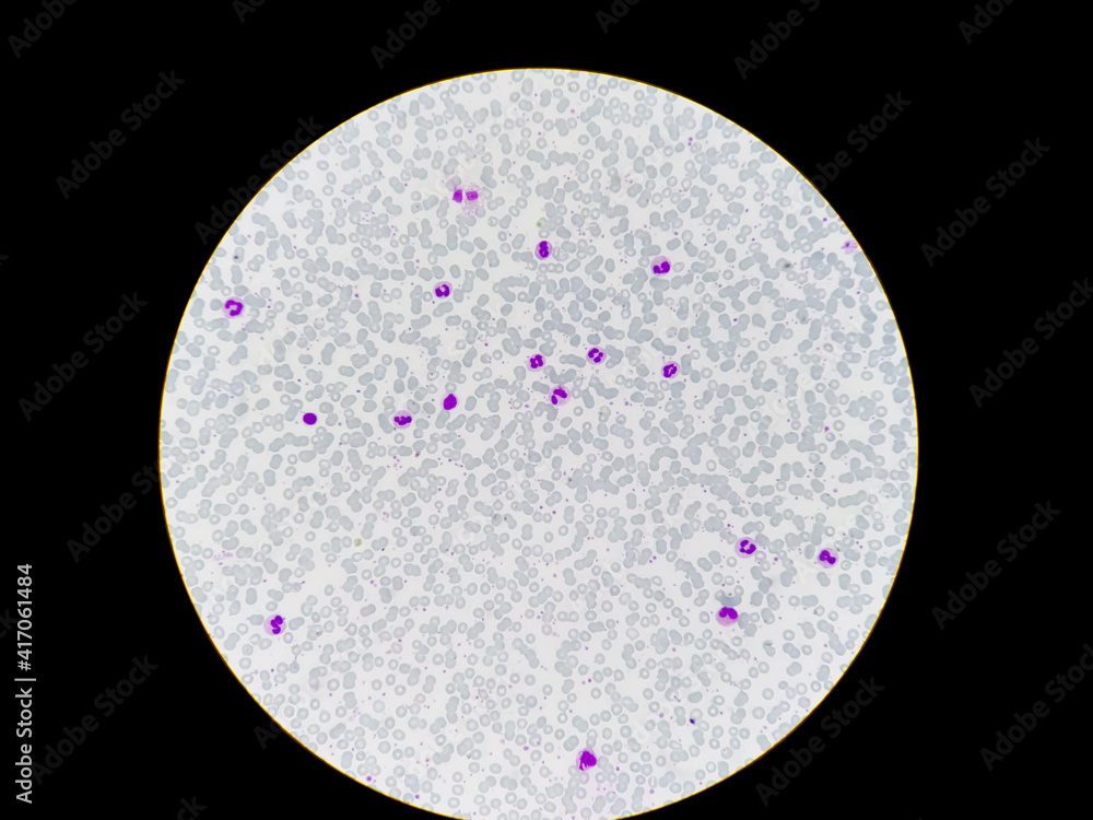 Human peripheral blood smear under 40x light microscope present ...