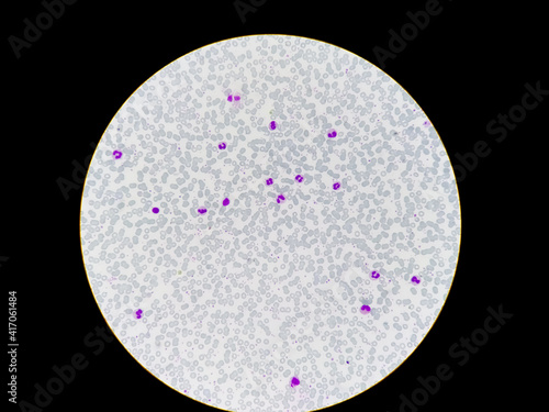 Human peripheral blood smear under 40x light microscope present ...