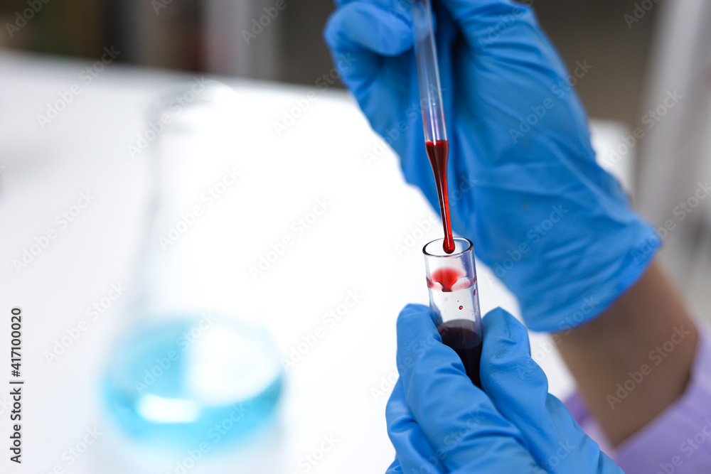 Scientist holding Coronavirus covid-19 infected blood sample tube DNA ...