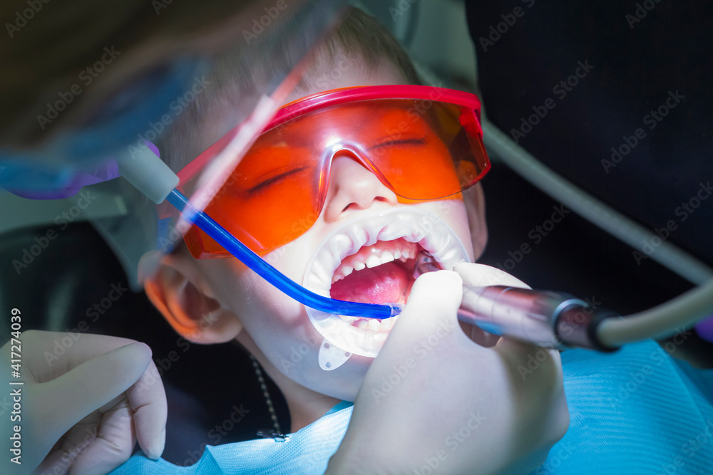 Kids dentistry. Children's dentist examination baby teeth. Emotions of ...