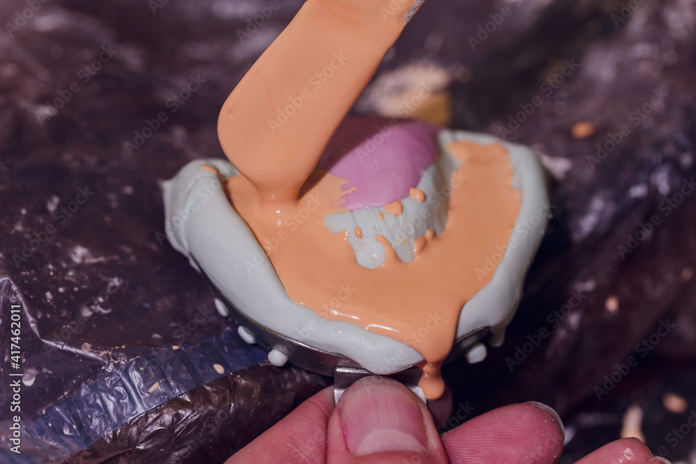 The process of making a dental prosthesis in a dental laboratory. Stock ...