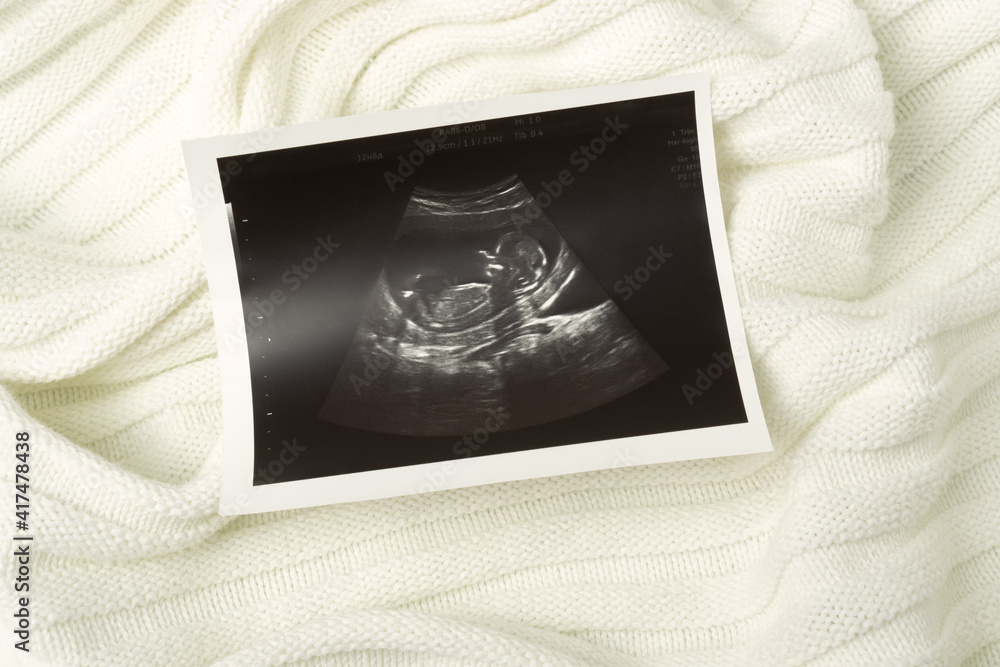 Image of baby during ultrasound examination on white soft fabric ...