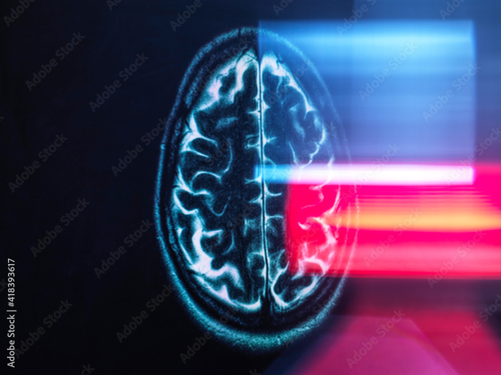 Refection of MRI brain scan on monitor display Stock-Foto | Adobe Stock