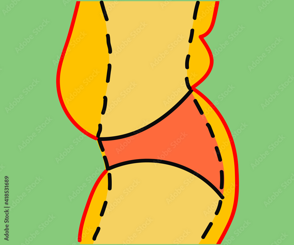 The female body before and after losing weight. Cartoon. Vector ...