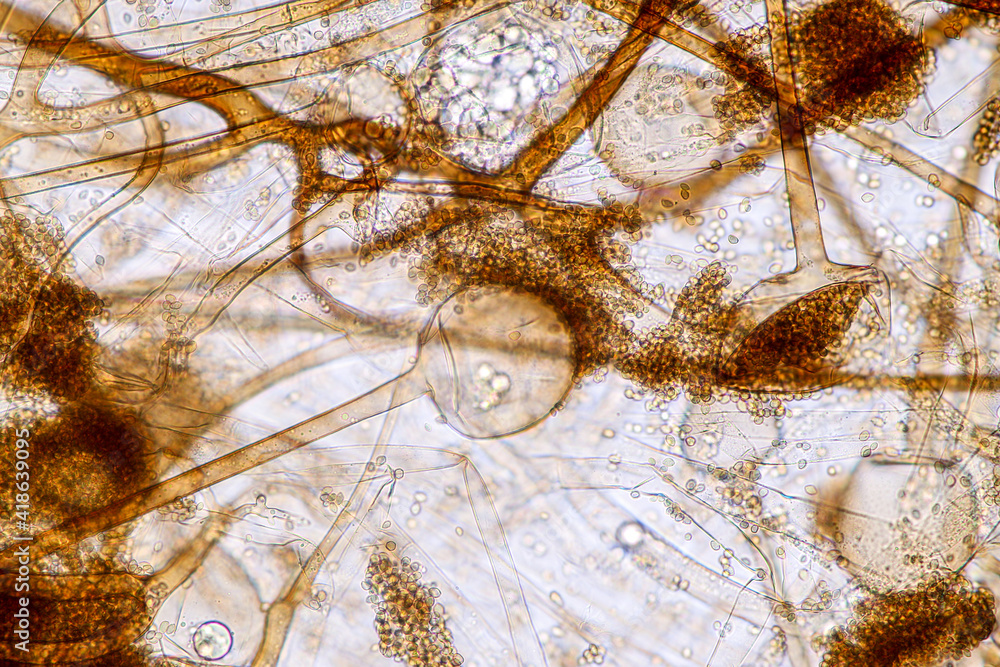 Characteristics of Rhizopus is a genus of common saprophytic fungi on ...