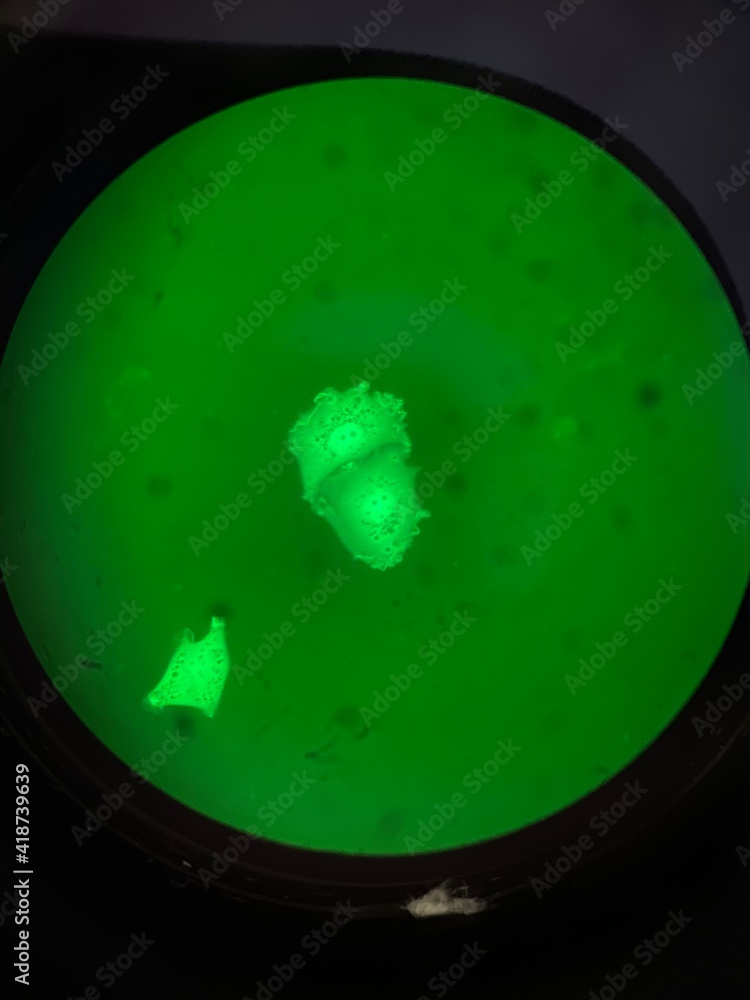 Cell transfection and expression of plasmid DNA encoding green ...