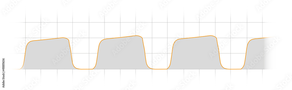 Arterial pulse waveformCapnography Waveform monitoring. Normal Curve ...