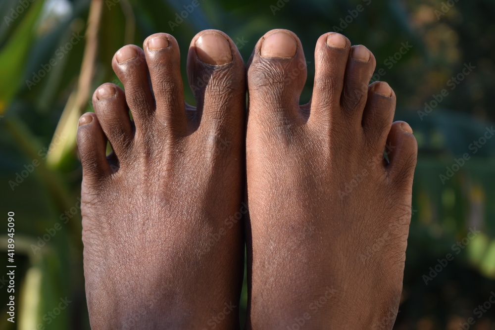 legs of Indian guy. Summer Concept. Stock Photo | Adobe Stock