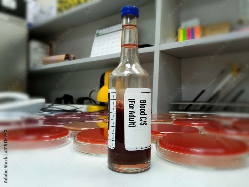 Culture bottles containing liquid media and human blood. For adult and ...