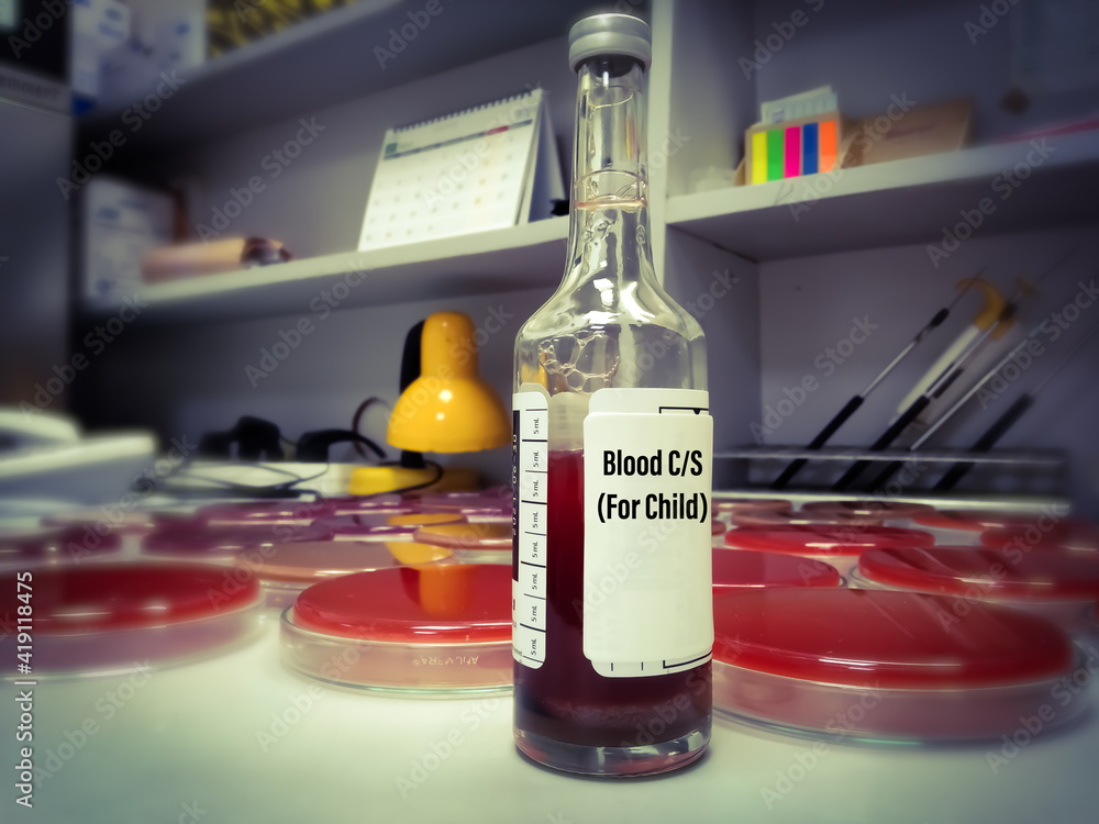 Culture bottles containing liquid media and human blood. For adult and ...
