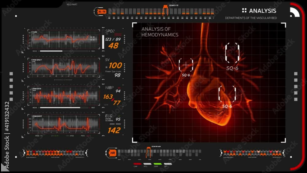 Medical HUD concept. Abstract graphs displays vital signs ECG. Diagrams ...