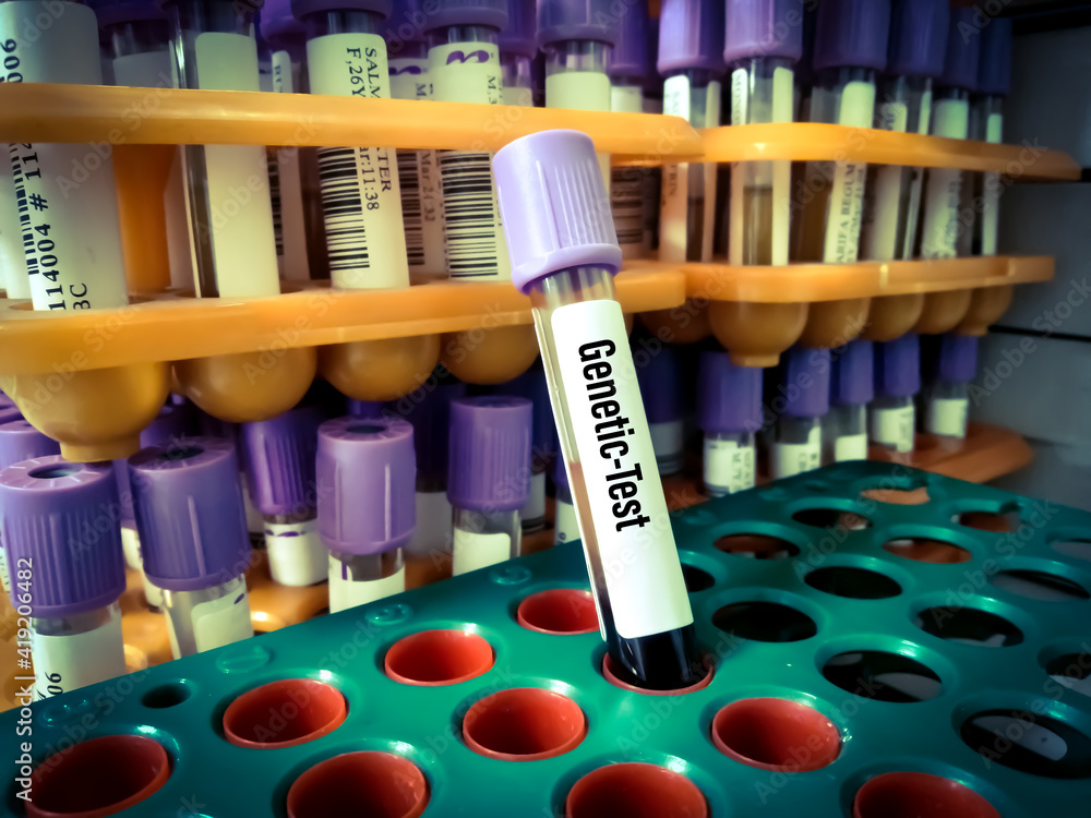 Genetic testing is a type of medical test that identifies changes in ...