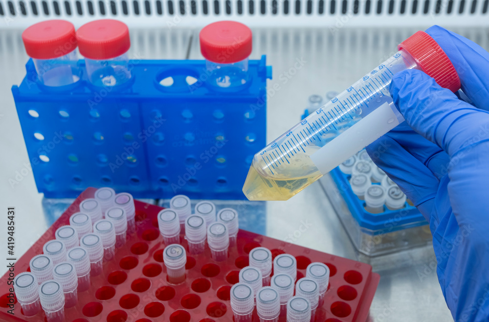 The scientist holds in his hand a large test tube with a sample of ...