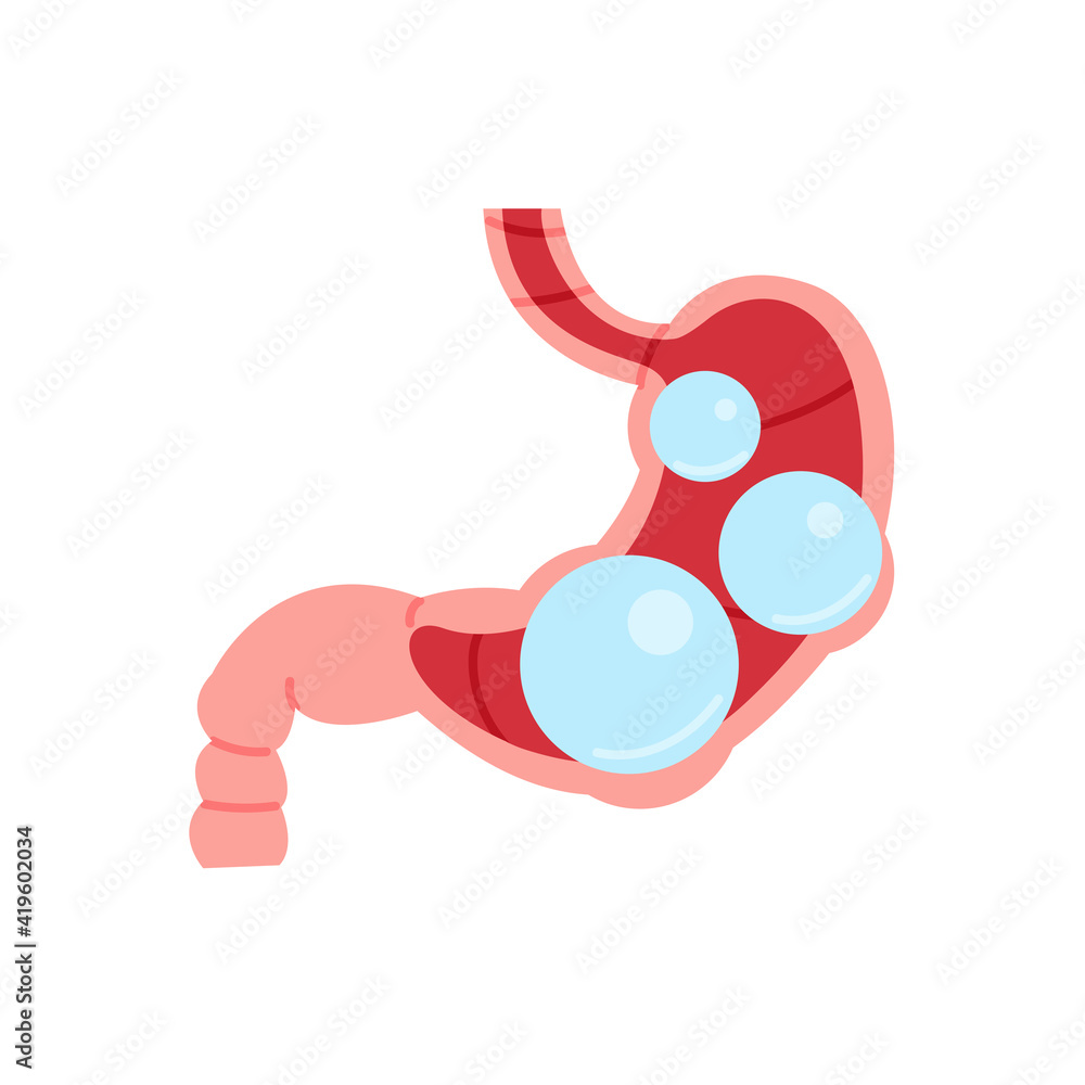Gases in stomach flat cartoon illustration. Bloating in digestive ...