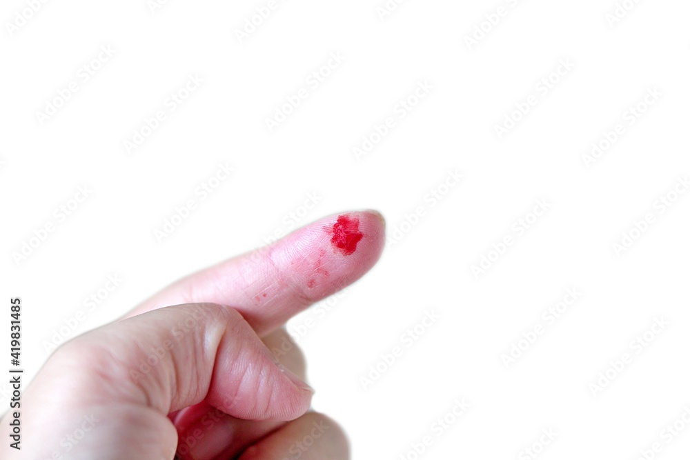 Finger cut knife, isolated on white background Stock Photo | Adobe Stock